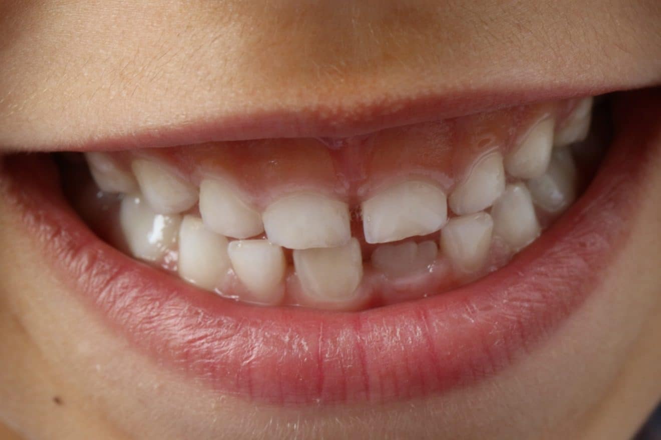 100 Crazy Facts That Will Definitely Freak You Out - Facts.net