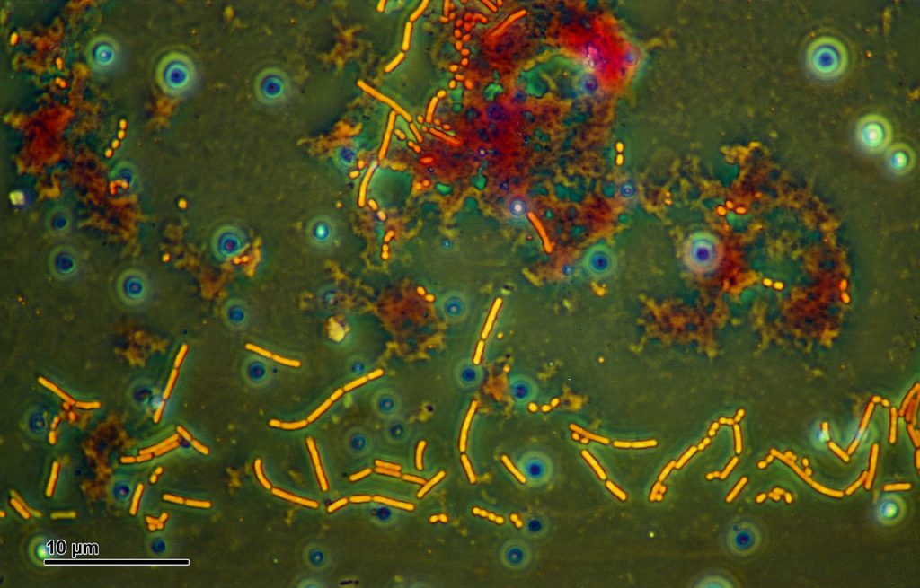 Eubacteria: 19 Fun Facts About These Fascinating Microorganisms - Facts.net