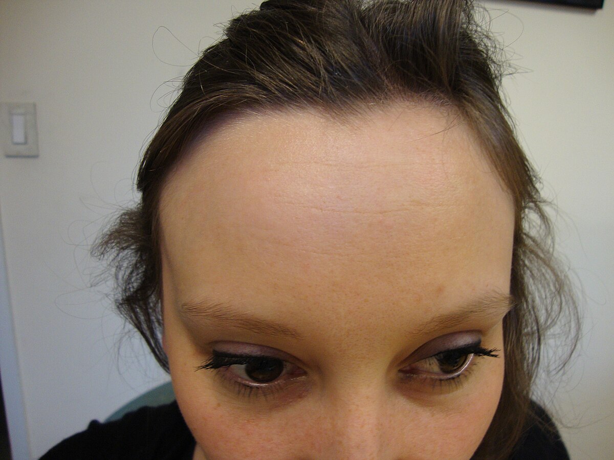 10 Fascinating Facts About Forehead Facts 10 Fascinating Facts About Forehead Facts