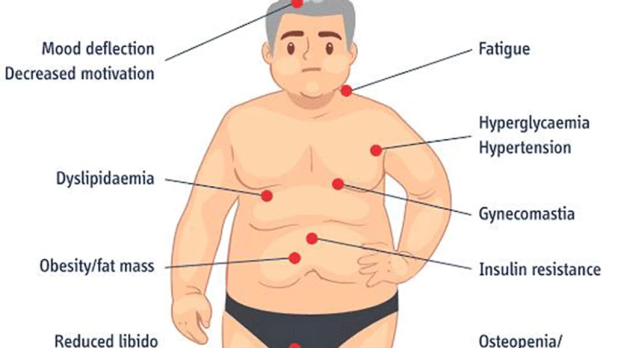 50 Facts About Hypogonadism Facts